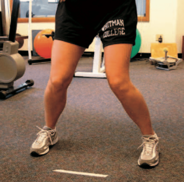 Understanding Valgus - The Science PT